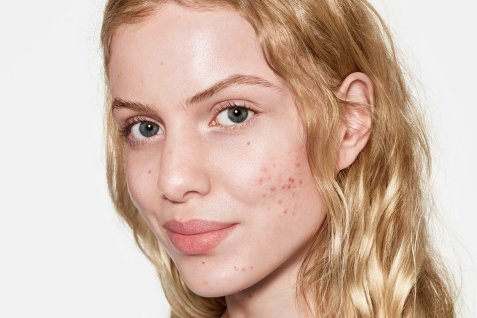 Skin Life Changers: Storie sulla Cura della Pelle | La Roche Posay